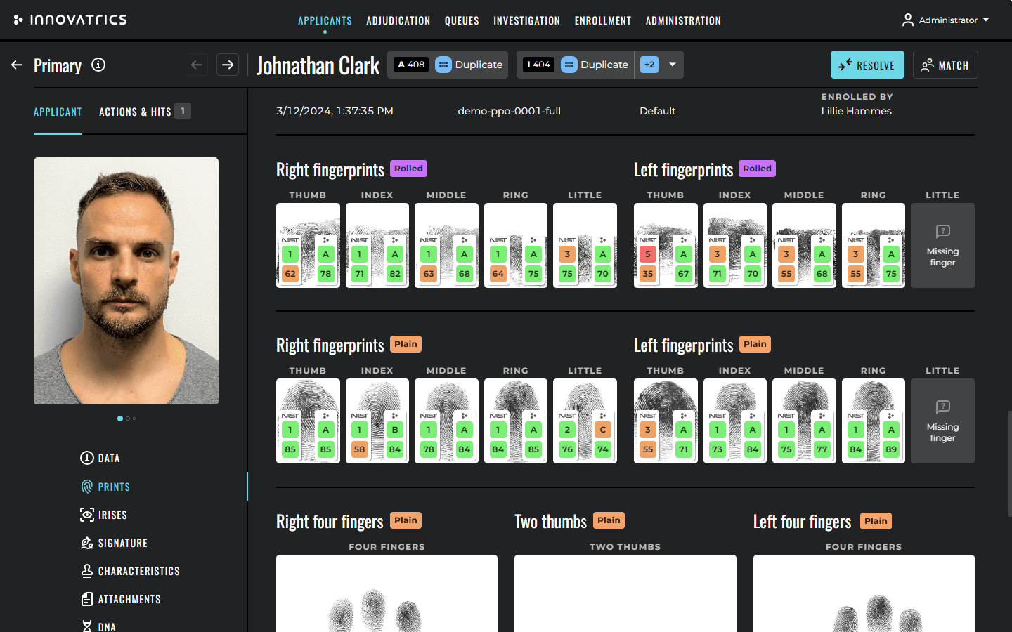Extracting a Biometric Sample - What It Is and Why It Matters | Innovatrics